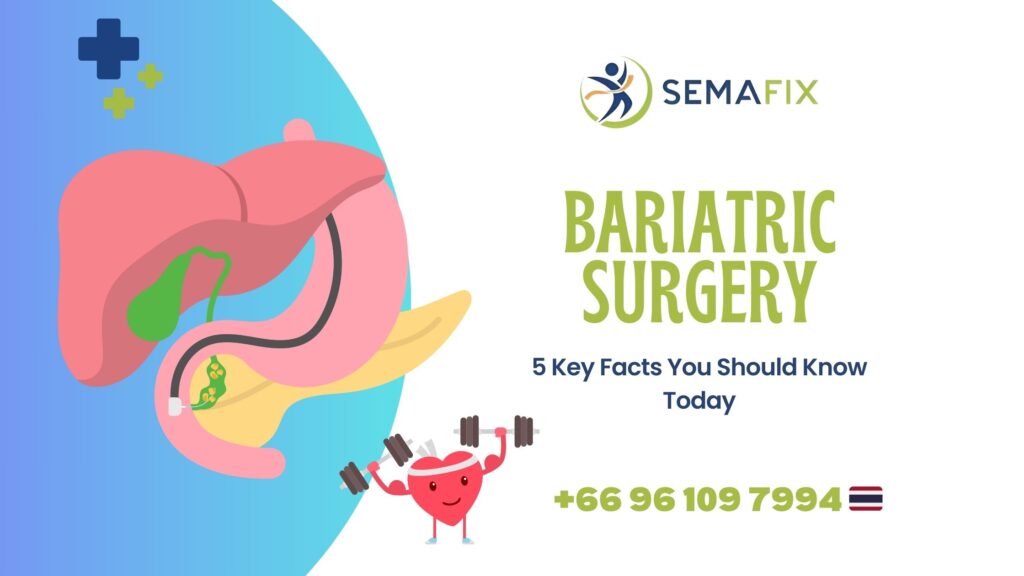 Bariatric Surgery: 5 Key Facts You Should Know Today